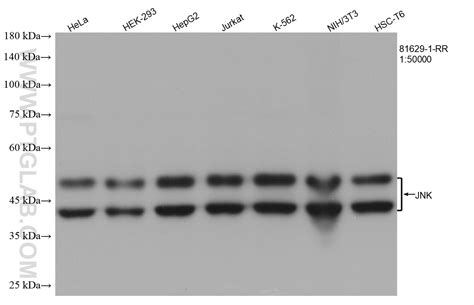 Jnk Antibody 81629 1 Rr Proteintech 武汉三鹰生物技术有限公司