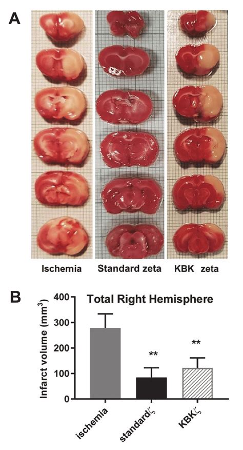 Infarct Volume Analysis Download Scientific Diagram