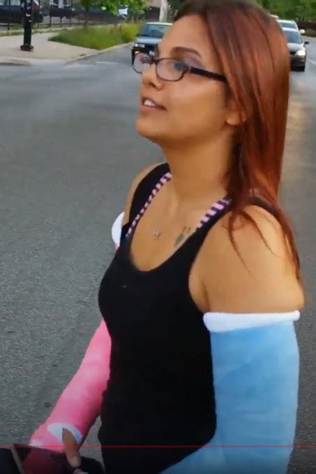 She Broke Both Her Arms Omg Castface Network For Casters