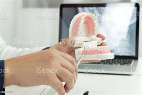 치과 진료소에서 환자 치아 의료 치료를 검사하는 치과 의사 건강 진단에 대한 스톡 사진 및 기타 이미지 건강 진단 건강관리와 의술 검사 보기 Istock