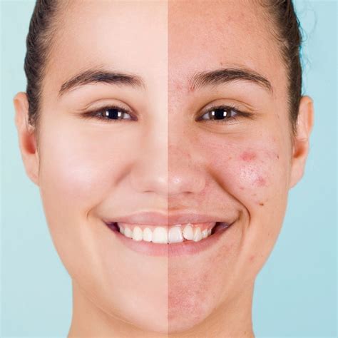 Homepage Revive Skin And Laser