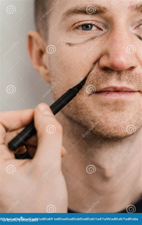 Male Blepharoplasty For Man Markup Plastic Surgeon Draws Markings On
