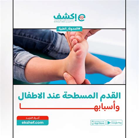 Ekshef يحتوي باطن القدم أو الجنب الداخلي من مشط القدم على قوس يمتد من