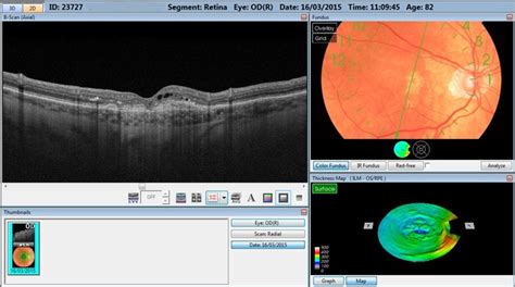 Dri Oct Triton Top Ophthalmic Products And Services Corp