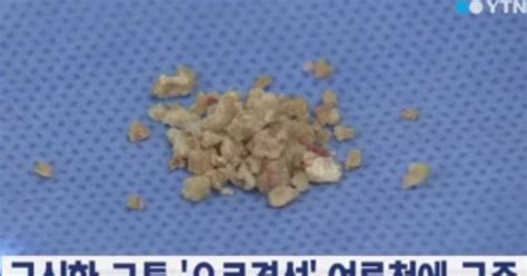 요로결석 증상 갑작스런 복부 통증 심할 경우 구토 혈뇨까지