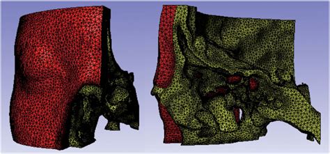 Three Finite Element Models Of The Orbit Were Produced And Used For Download Scientific Diagram