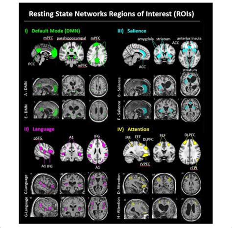 Resting State Networks Regions Of Interest Roi I Dmn Panel I Download Scientific