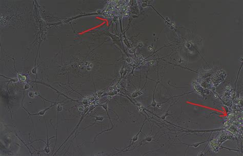 Can Anybody Suggest A Best Protocol For Culturing Primary Cortical