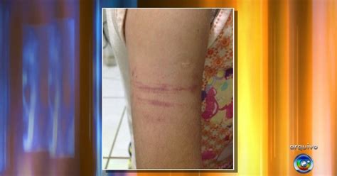 G1 Secretaria demite professora suspeita de agredir criança