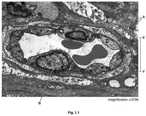 A Level Biology 1 1 The Microscope In Cells Study Exam Style Question