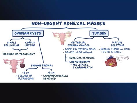 Pelvic Masses 02122020