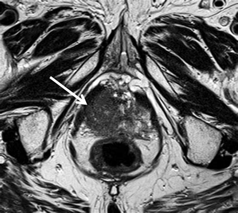Magnetresonanztomographie MRT Kernspintomographie
