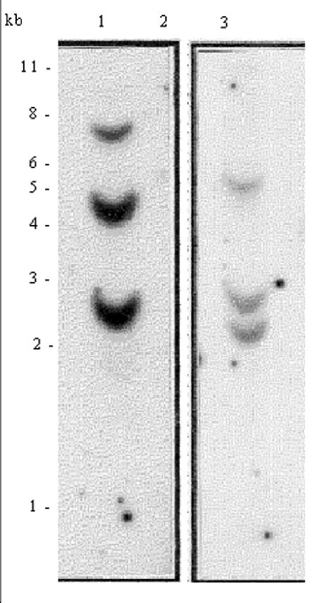Southern Blot Hybridization Of Genomic Dna From Potato Plants