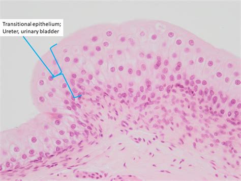 Transitional Epithelium Ureter