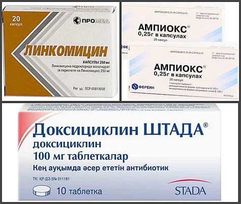 Антибиотики при удалении