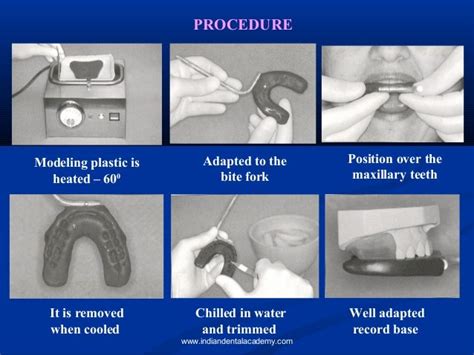 Hinge Axis Certified Fixed Orthodontic Courses By Indian Dental Acad