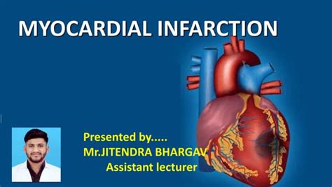 Myocardial Infarction Slideshare Ppt