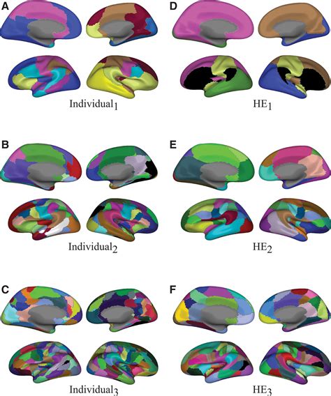 Optimizing Connectivity Driven Brain Parcellation Using Ensemble