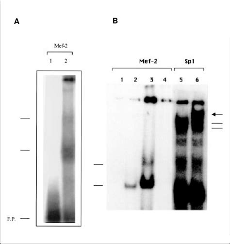 Gel Shift Analysis Using Dna Binding Protein Extracts Generated By The