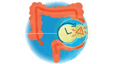 For Your Patients Possible Long Term Complications Of Ulcerative