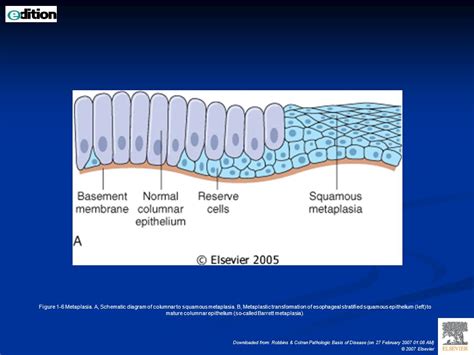 Cellular Adaptations Cell Injury And Cell Death Ppt Download
