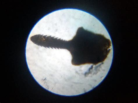 Tick Head Under Microscope 450x Read How To Remove Stuck Tick Heads In