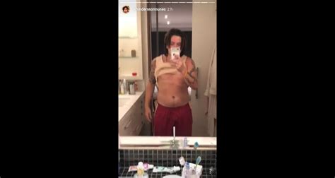 Vídeo Whindersson Nunes fala sobre emagrecimento e mostra barriga sem