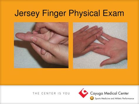 Ppt Common Hand And Wrist Injuries Powerpoint Presentation Id 3950482