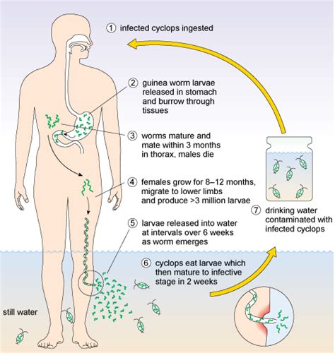 Dracunculus Medinensis Life Cycle