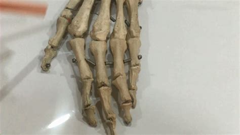 آناتومی استخوان های دست Hand Bones Anatomy