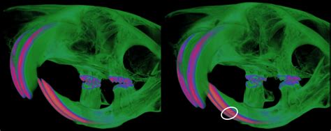 A Link Between Autoimmune Disorders And Tooth Enamel Defects Revealed