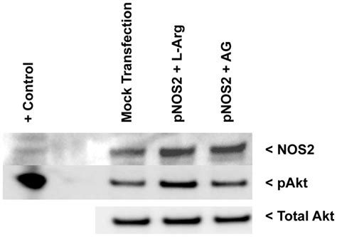 Transfection Of Nos2 Expression Plamid Enhances Pakt Nos2