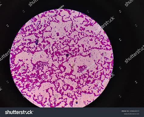 Bakterienzelle Unter Dem Mikroskop 100x