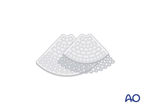 Orbital Reconstruction For Orbital Floor Fracture