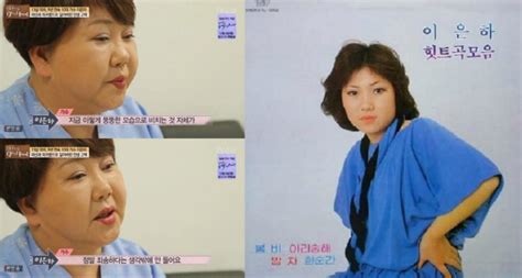 이은하 앓는 쿠싱증후군스테로이드가 원인 서울경제