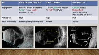 B Scan Procedure Basics In Ophthalmology Pptx