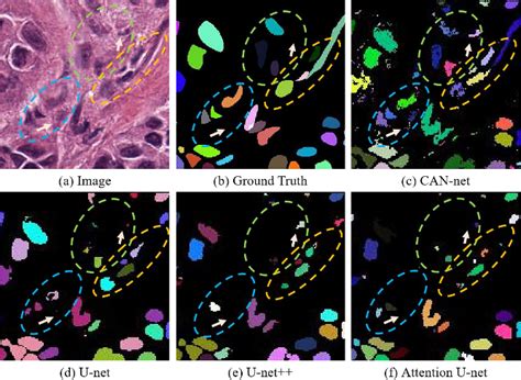 Figure From The Contrastive Network With Convolution And Self Attention Mechanisms For