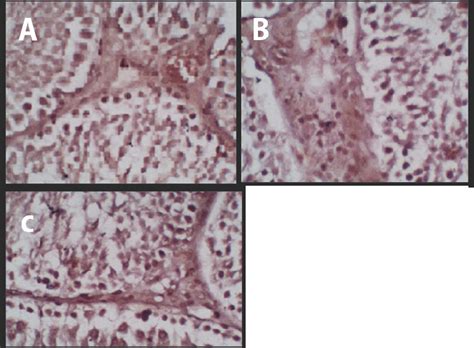 Immunohistochemistry Of The P53 Protein Expression A Negative