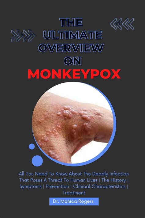 THE ULTIMATE OVERVIEW ON MONKEYPOX: All You Need To Know About The ...