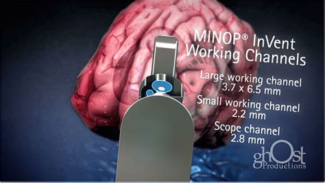 Minop Invent Device Image
