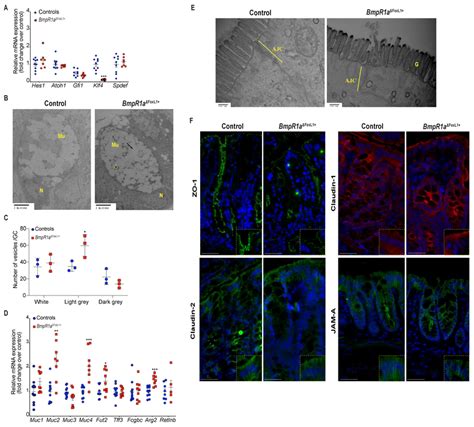Schematic Representation Of Ibd Pathogenesis Events In Colonic Mucosa Download Scientific