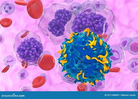 Car T Cell Therapy In Plasma Cell Leukemia Pcl Closeup View 3d