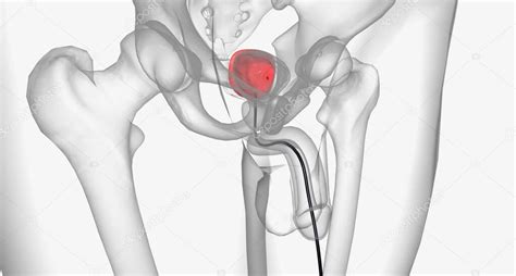 La Cistoscopia Es Un Procedimiento Que Se Usa Para Observar El Interior De La Vejiga Y La Uretra