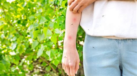 Invasión De Mosquitos En El Amba Por Qué Se Produce Cuánto Podría