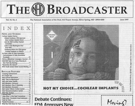 Deaf Communitys Perception Cochlear Implants
