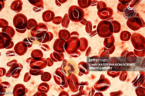 Polycythemia Vera Illustration High Res Vector Graphic Getty Images
