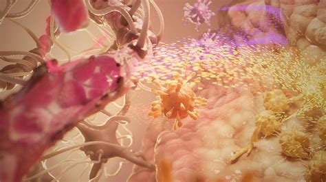 Impactful Journey With Sensu In Brain Cancer Treatment
