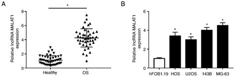 Malat1 Is Upregulated In Os Tissues And Cells A Reverse
