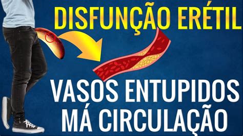 DISFUNÇÃO ERÉTIL veias do pênis entupidas YouTube