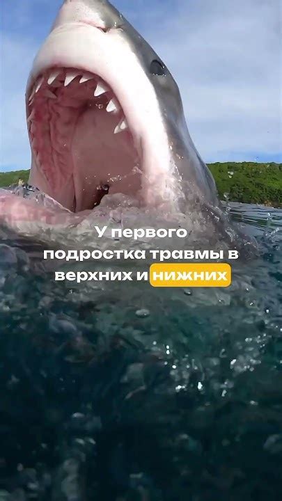 В США Акула напала на людей. Пострадало 3 человека, 2е из них ...